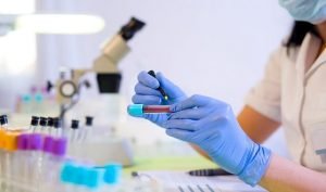 Bachelor of Medical Laboratory Technology [BMLT] Course: Details ...